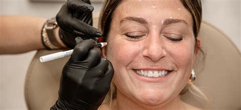 How Many Units Of Botox Per Area Do I Need Elase