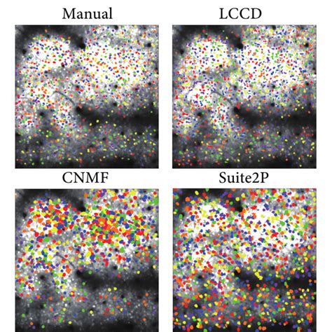 Schematic Diagram Of Lccd Taking Temporal Division And Integration Download Scientific Diagram