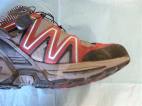 Foot And Ankle Problems By Dr Richard Blake 10 Common Shoe