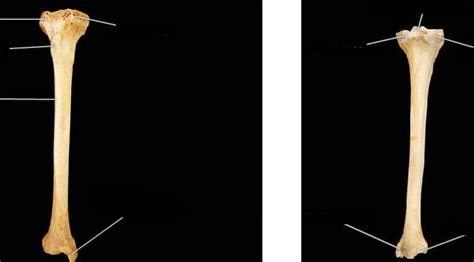 Tibia Diagram Quizlet