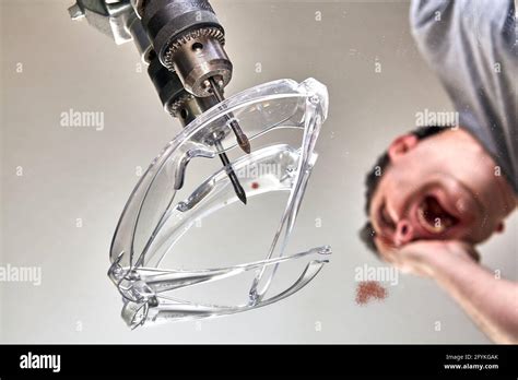 Injury In Workplace As Result Of Safety Violations Drill Bit Pierced Of Protective Glasses