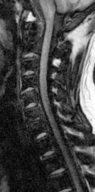 Psif Questions And Answers In Mri