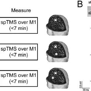 A Schematic Representation Of Experimental Design And TMS Download Scientific Diagram