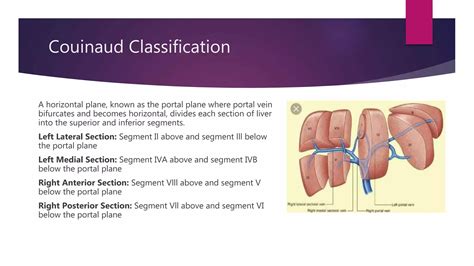 Anatomical Division Of Liver Pptx