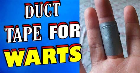 Duct Tape For Removing Warts This Treatment Is Backed By Science Health And Love Page