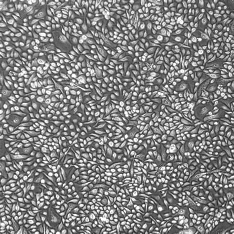 Mammary Epithelial Primary Cells