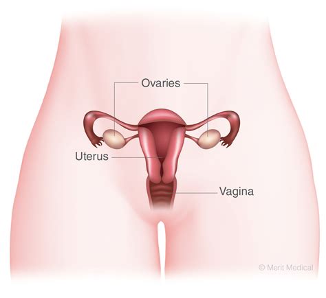 Uterine Fibroid Embolization South Jersey Lourdes Imaging Associates