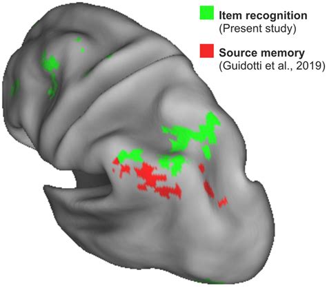 Choice Predictive Activity In Item Recognition And Source Memory The Download Scientific