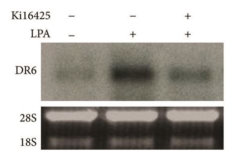 LPA Induced DR6 Upregulation Is Mediated By LPA Receptors 1 3