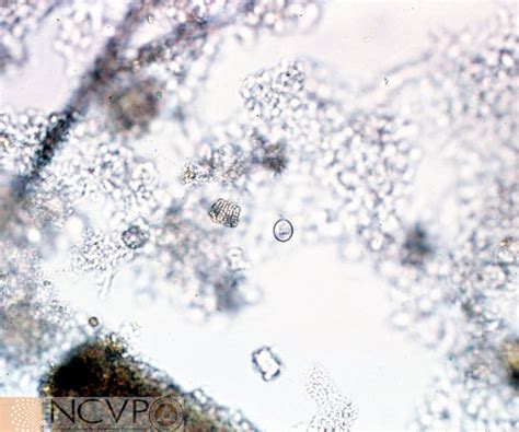Coccidia Egg