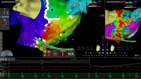 [video] Carlo Quaglia On Linkedin From Flutter To Sinus Rythme In 9