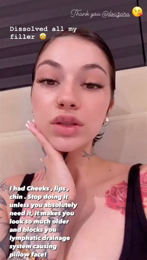 Bhad Bhabie Dissolved Her Fillers Warns People To Stop Getting Them