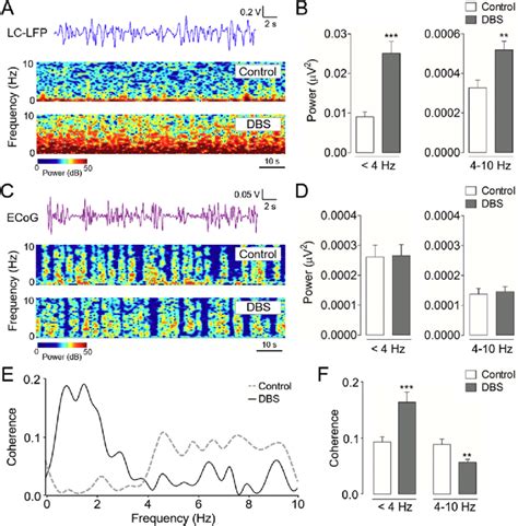 Effect Of DBS On LC LFP ECoG And Coherence A Example Of The Low Download Scientific Diagram