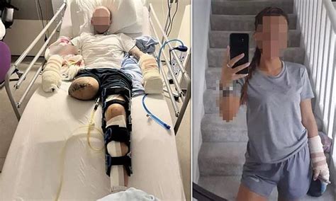 Two Men Charged Over Machete Attack Which Forced Man 28 To Have His