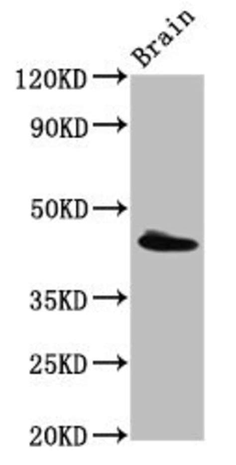 Invitrogen Pex13 Polyclonal Antibody 100 μg Unconjugatedantibodies