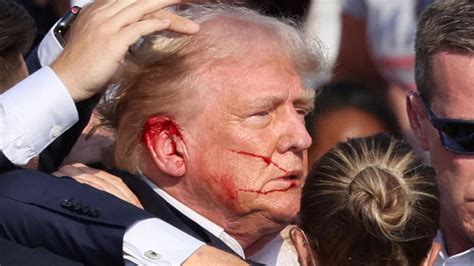 Sentí La Bala Desgarrando Mi Piel La Reacción De Trump Tras Recibir Un Disparo En La Oreja En