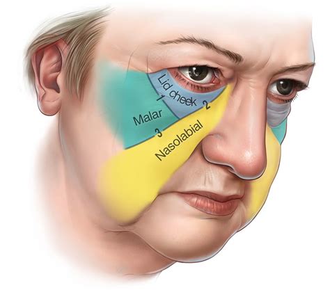 Facial Bones Near Eye At Dean Paul Blog