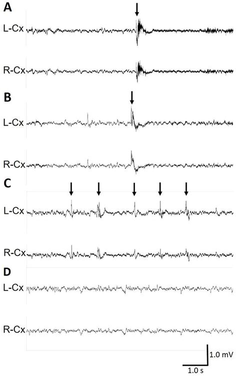 X Linked Cellular Mosaicism Underlies Age Dependent Occurrence Of Seizure Like Events In Mouse