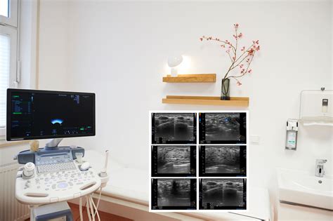 Diagnostik Und Therapie Von Brusterkrankungen MVZ RetiMed