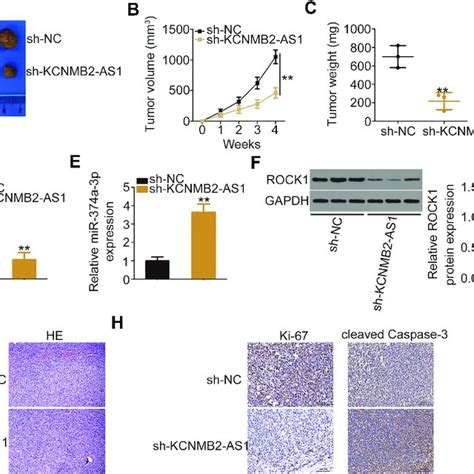 Loss Of Kcnmb2 As1 Impairs Nsclc Cell Tumor Growth In Vivo A Tumor