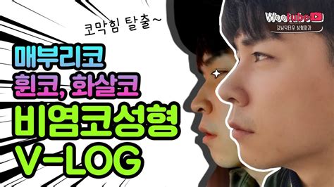 강남닥터우 코성형 비염코성형 브이로그 Youtube