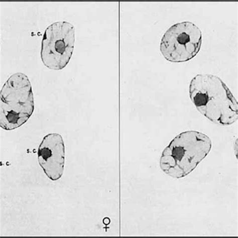 Sex Chromatin Cell Nuclei From The Foot Pad Skin Of Cats The Left
