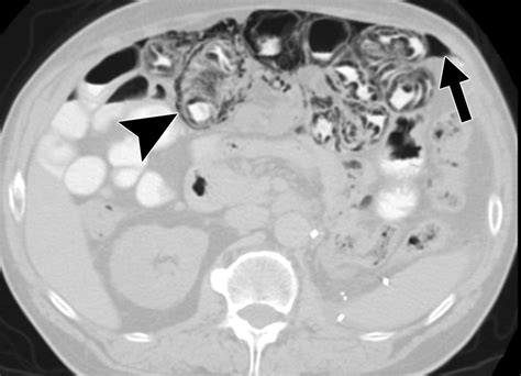 Genitourinary Imaging Part 2 Role Of Imaging In Medical Management Of