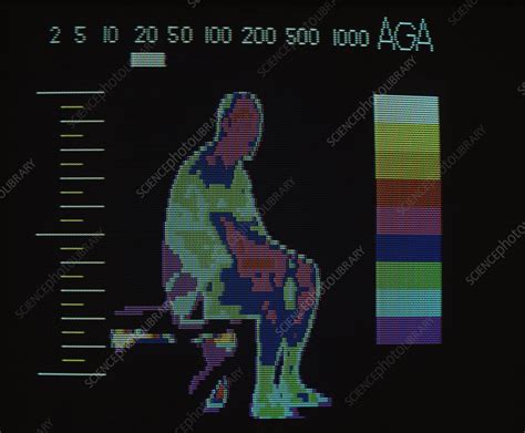 Thermogram Of Man Before Playing Squash Stock Image P800 0060