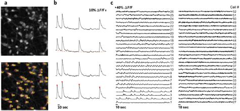 Automated Segmentation Fluorescence Trace Estimation And Spike Train