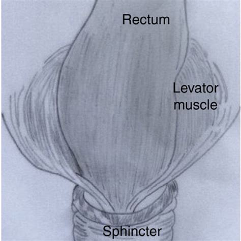 Pubococcygeal Line T2 Weighted Midsagittal Mr Image Of A Female Pelvis Download Scientific