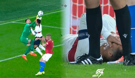 Portugal vs República Checa Cristiano Ronaldo quedó con el tabique
