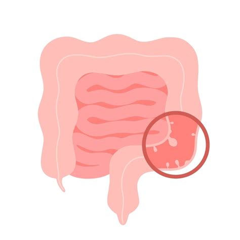 547 Colon Checkup Royalty Free Photos And Stock Images Shutterstock