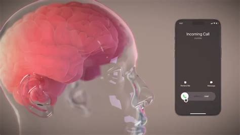 dr anup n on linkedin ai artificialintelligence