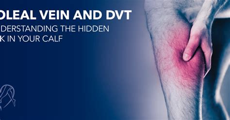 Soleus Vein Anatomy Soleal Vein And Dvt Understanding The Hidden Risk