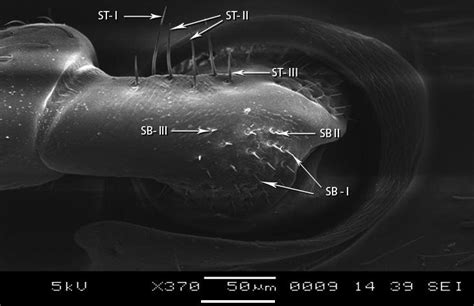 Sem Structure Of Scape Ball Showing Three Types Of Sensilla Basiconica