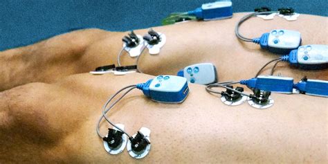 Elektromyografie Emg