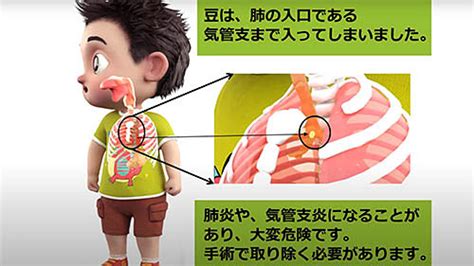 明日2月3日木は節分 5歳以下には硬い豆やナッツ類は食べさせないよう消費者庁が注意喚起～節分の豆まきの事故に注意 誤嚥して入院した症例