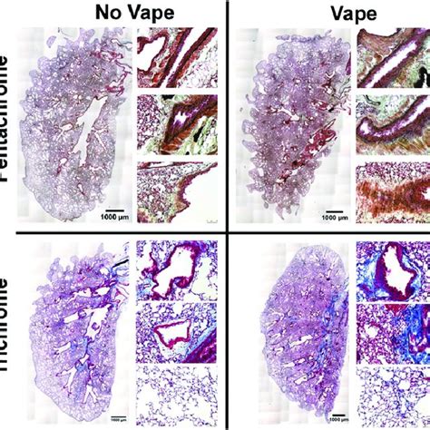 Mucin Accumulation In Bronchial Airways Of Vaped Mice A Periodic