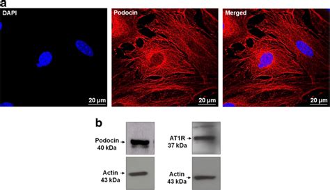 A Immunofluorescence Staining Of Podocin In Conditionally Immortalized
