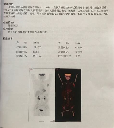 淋巴癌结节图片 淋巴图片 耳后淋巴图片 第4页 大山谷图库