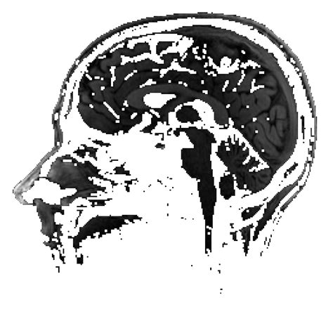 Mri Image Analysis In Python — Art Of Thinking