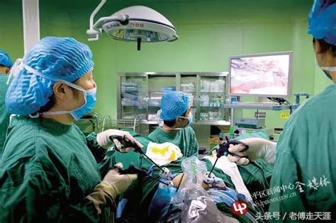 梁平區醫院更厲害了，為10餘女人做惡性腫瘤手術~無一併發症！ 每日頭條