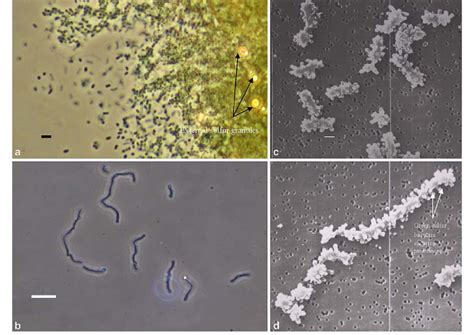 Phase Contrast And Scanning Electron Microphotographs Of Two Different