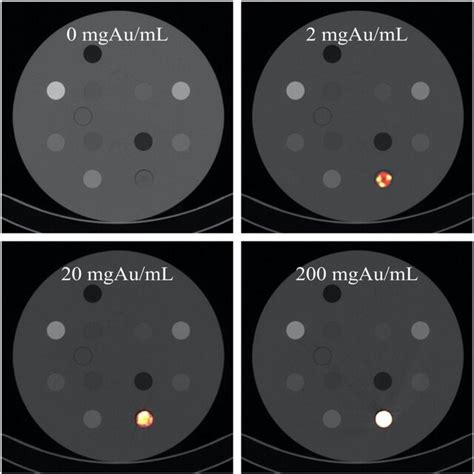 Gold Nanoparticle Computed Tomography Contrast In A 33‐cm Phantom