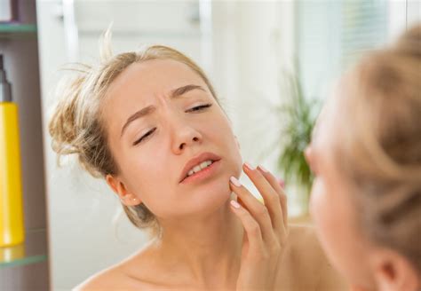Consejos Para Proteger La Piel En Invierno Cio Salud