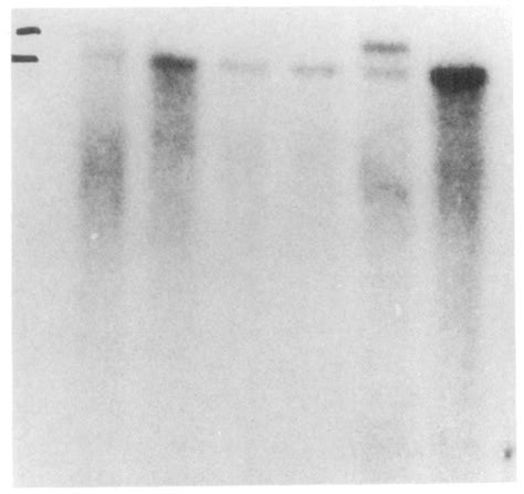Southern Blot Hybridization Of Probe Pdp34 To Taqi Digested Dnas From