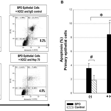 Recombinant Human Hsp 70 Decreases H2o2 Induced Airway Epithelial Cell