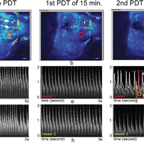 laser speckle imaging and phase resolved doppler oct measurements
