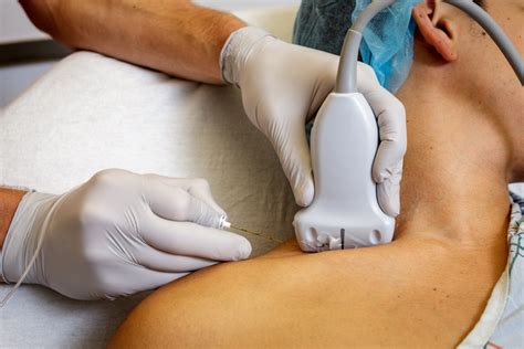 Bloqueio Dos Nervos Como Eles Reduzem As Dores Nos Membros