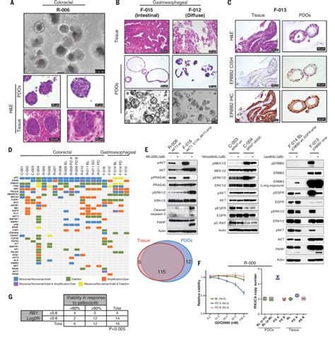 Histopathological Molecular And Functional Characterization Of